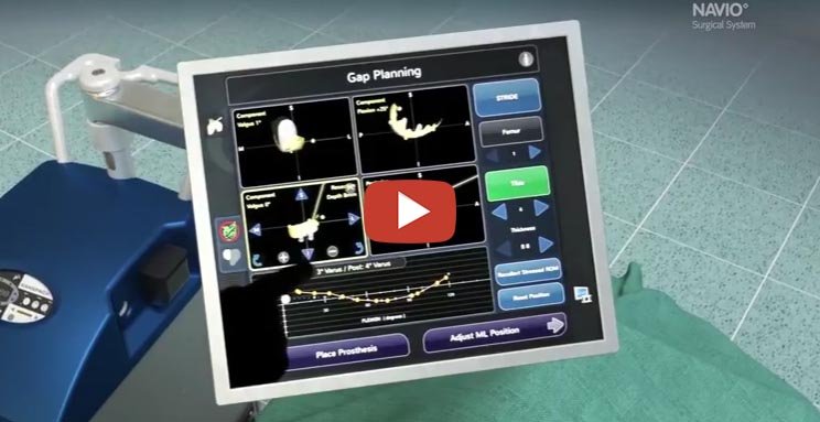 Dr Michael Swank | Hip Surgeon Cincinnati | Knee Surgeon Cincinnati, Ohio